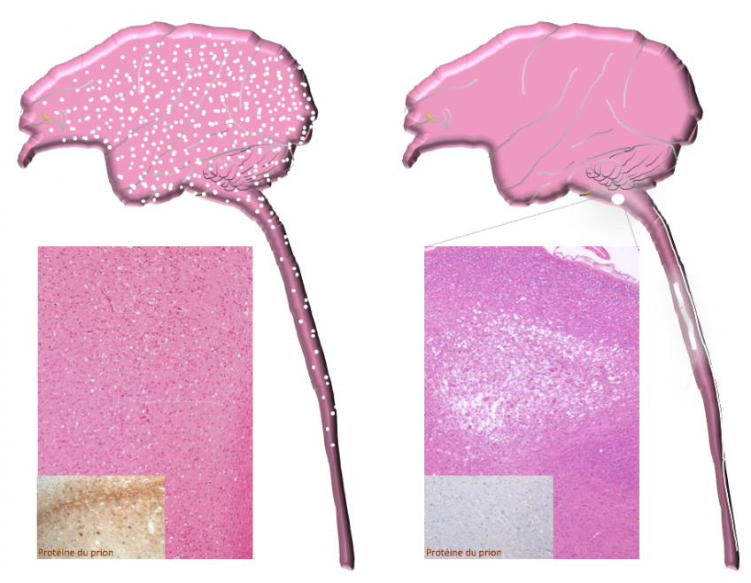 New forms of expression of the variant of Creutzfeldt-Jakob disease ...