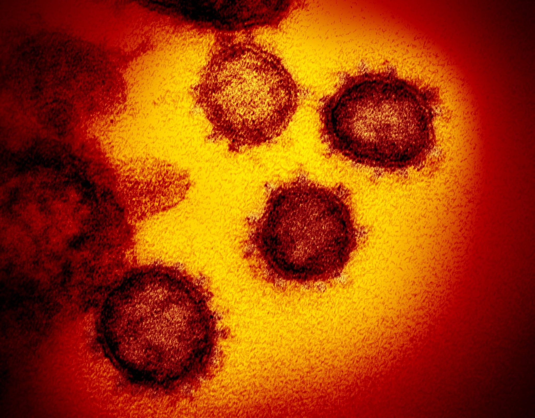 Long COVID: The Persistence of SARS-CoV-2 in the Mucous Membranes May ...